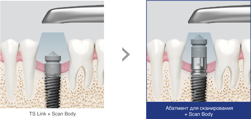 Link Абатмент для Cerec